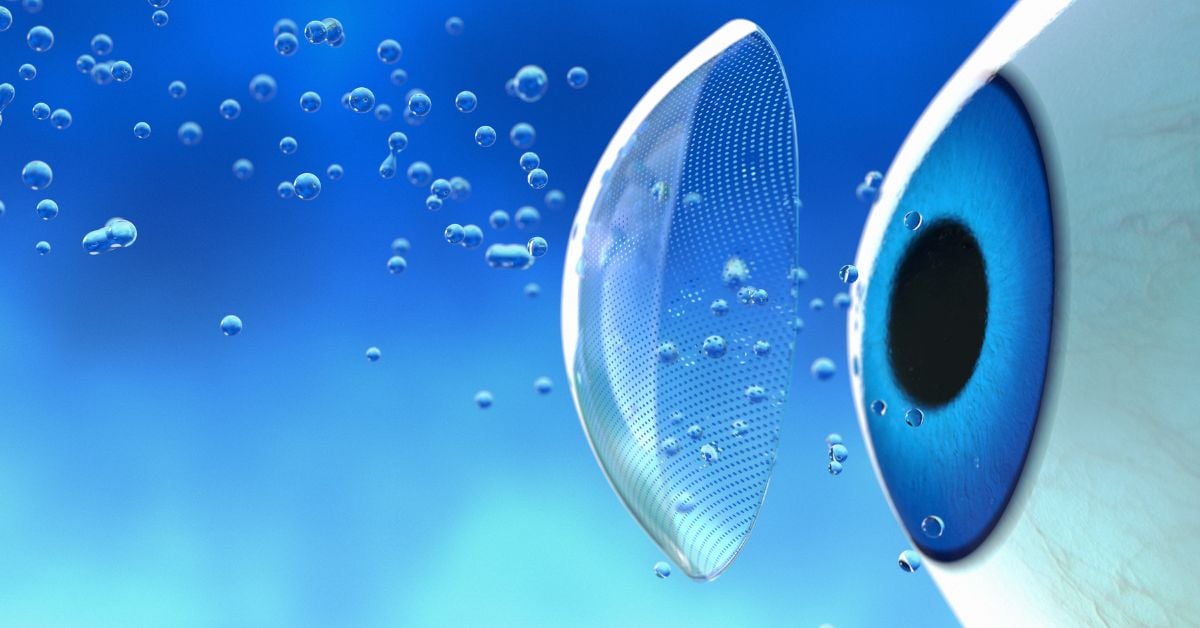 Contact lens intolerance – what is it, and how can you deal with it ...