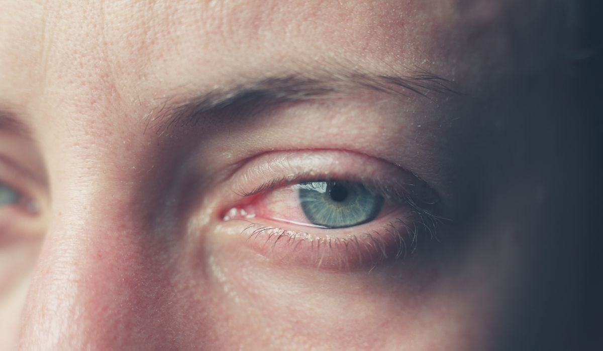 Crying or not, tears are important - J and S vision